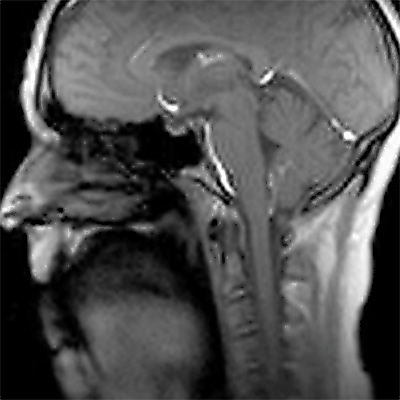 New superfast MRI technique demonstrated with song, 'If I Only Had a ...