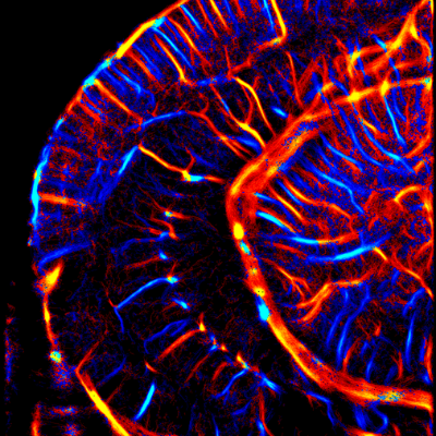 Three bioengineering projects awarded Jump ARCHES grants ...