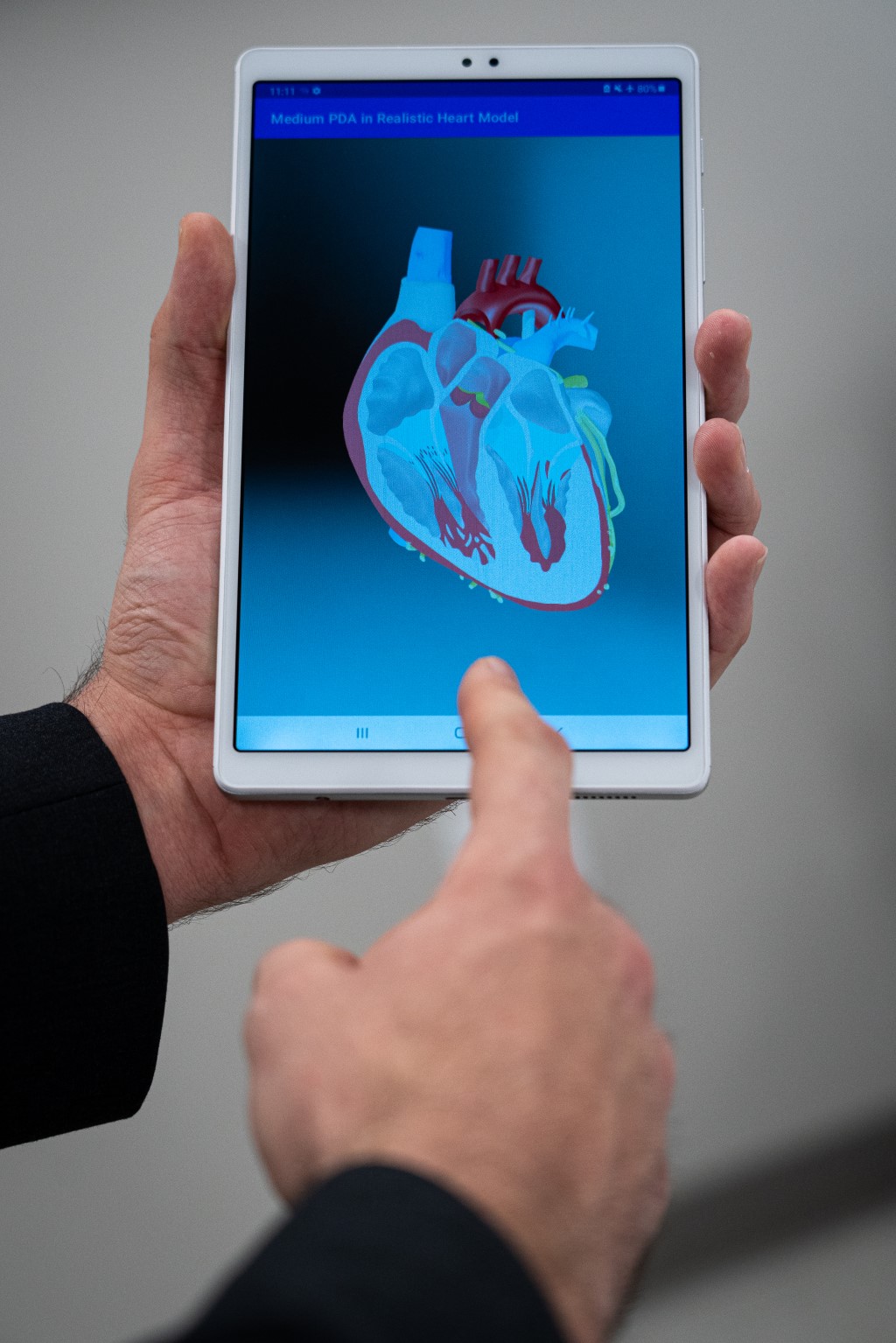 Personalized Pediatric Cardiac Ed Tools | Bioengineering | Illinois